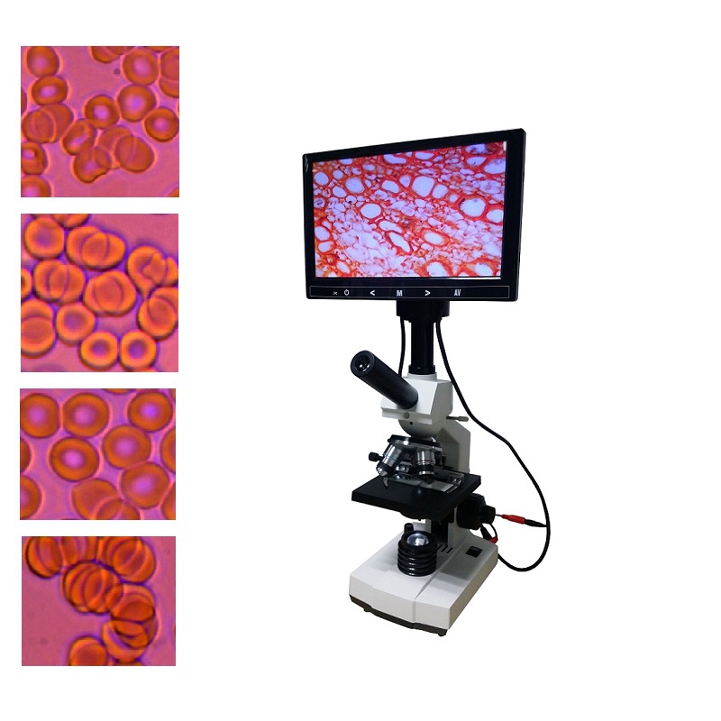 BD-YDX2001 LCD Biological Microscope for living blood analysis-Shenzhen ...